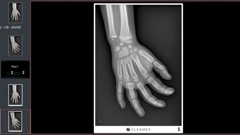 Gleamer AI – Be Healthcare